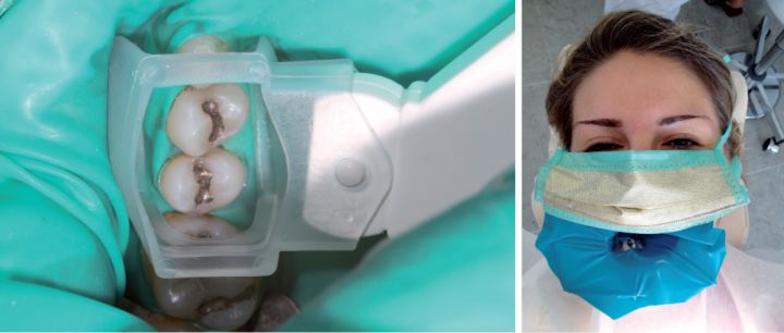 Biologische Zahnmedizin: Metallsanierung